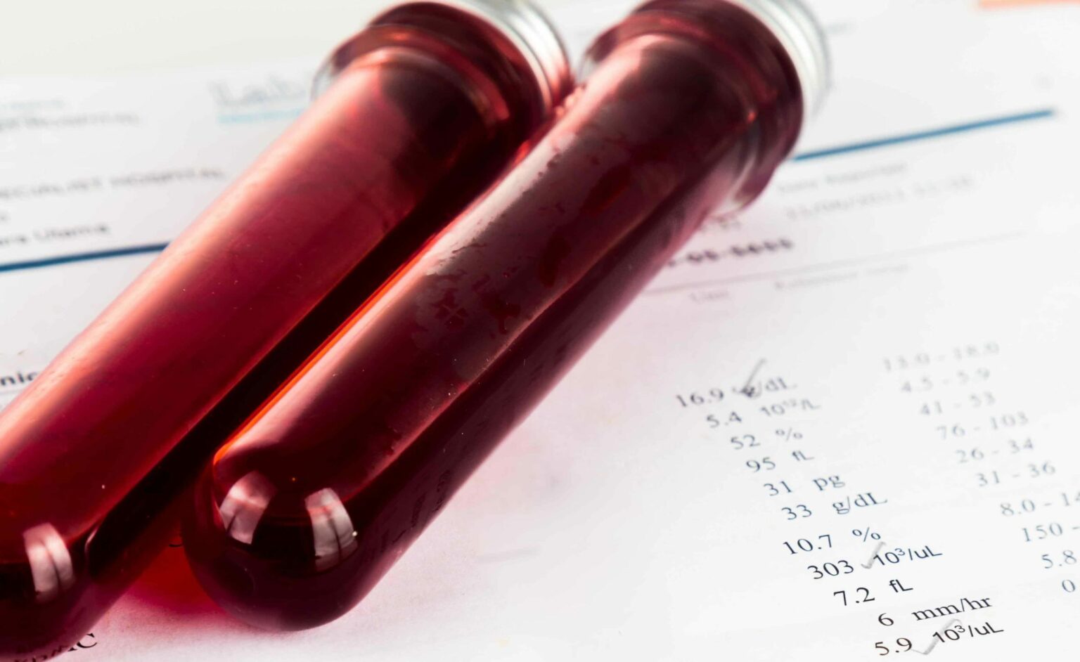 NAROČANJE IN DRUGI DIGITALNI KONTAKTI - Humano